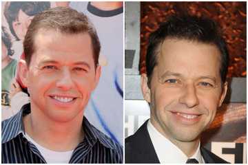 25 male hair transplant celebrities before and after (with photos ...