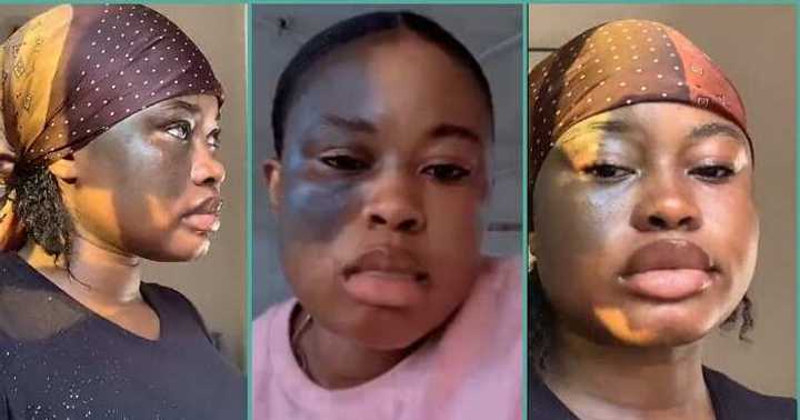 Video Of Nigerian Lady With Unusual Birthmark Goes Viral: "Everyone ...
